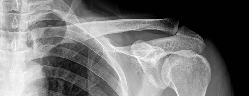 Imaging and Radiology Center Design | Design & Construction | BioSpace